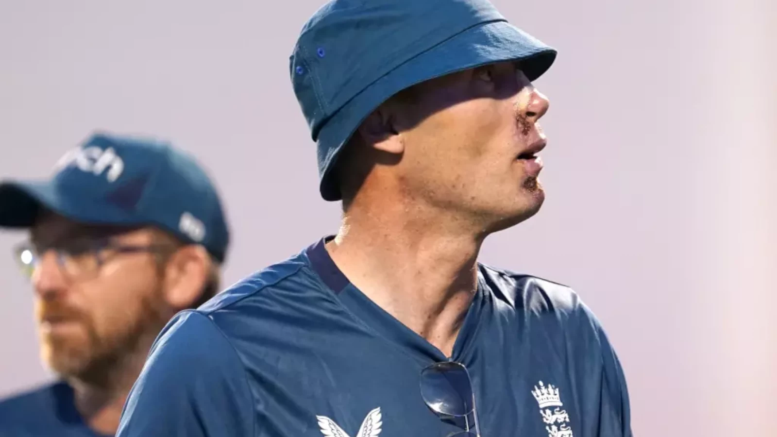 Andrew Flintoff seen for first time since suffering facial injuries in ...